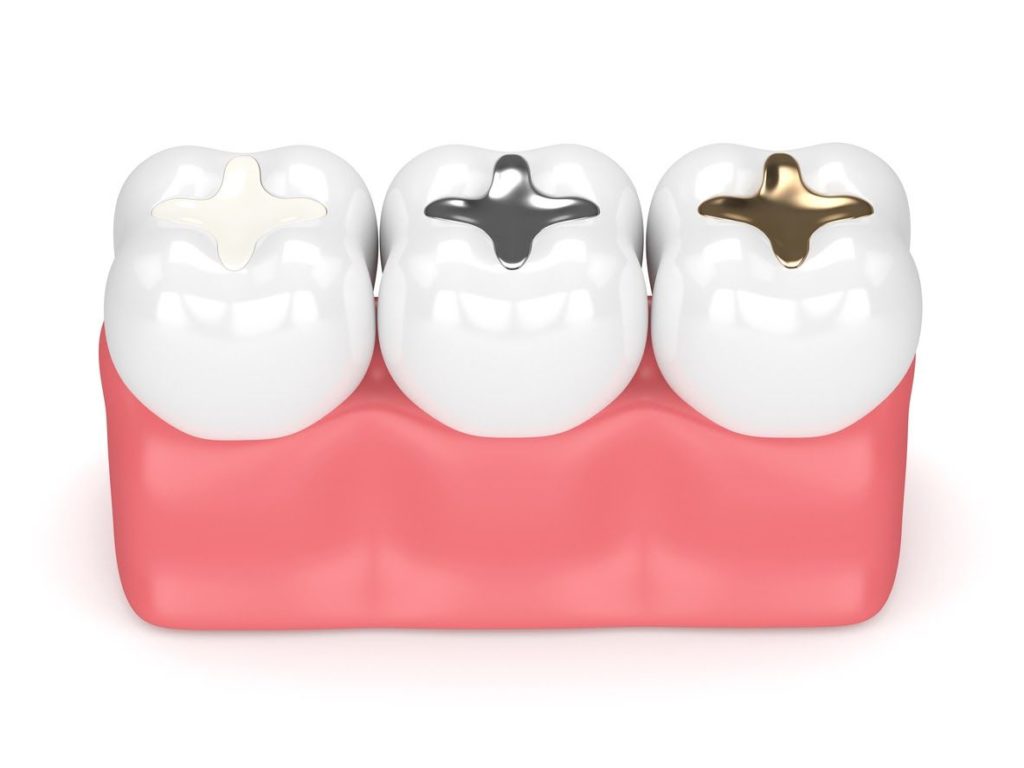 Crown vs. Filling: What’s the Difference?